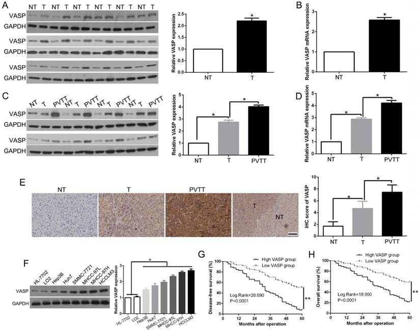 Hypoxia-induced up-regulation of VASP promotes invasiveness and ...