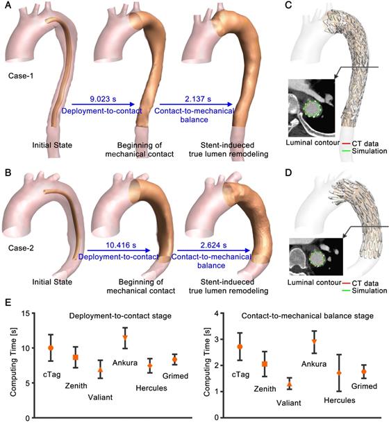 Virtual stenting with simplex mesh and mechanical contact analysis for ...