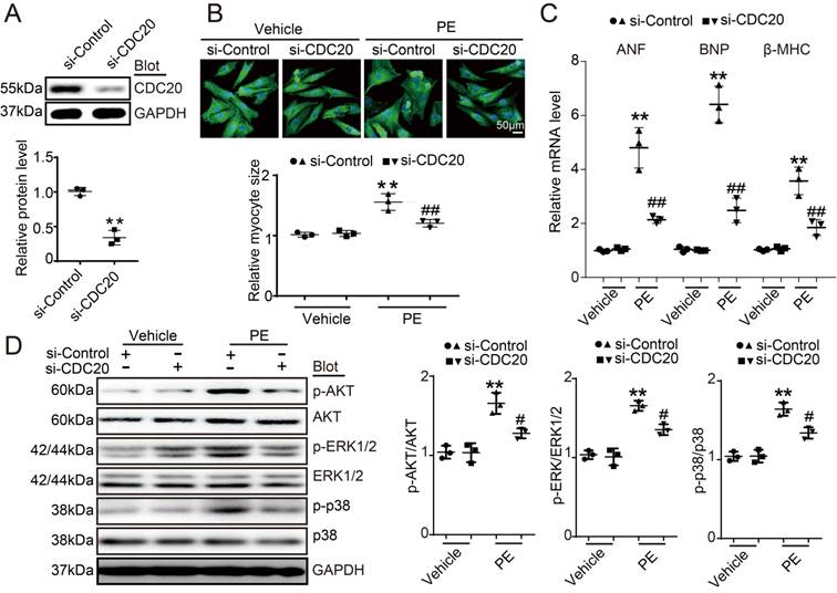 CDC20 regulates cardiac hypertrophy via targeting LC3-dependent autophagy