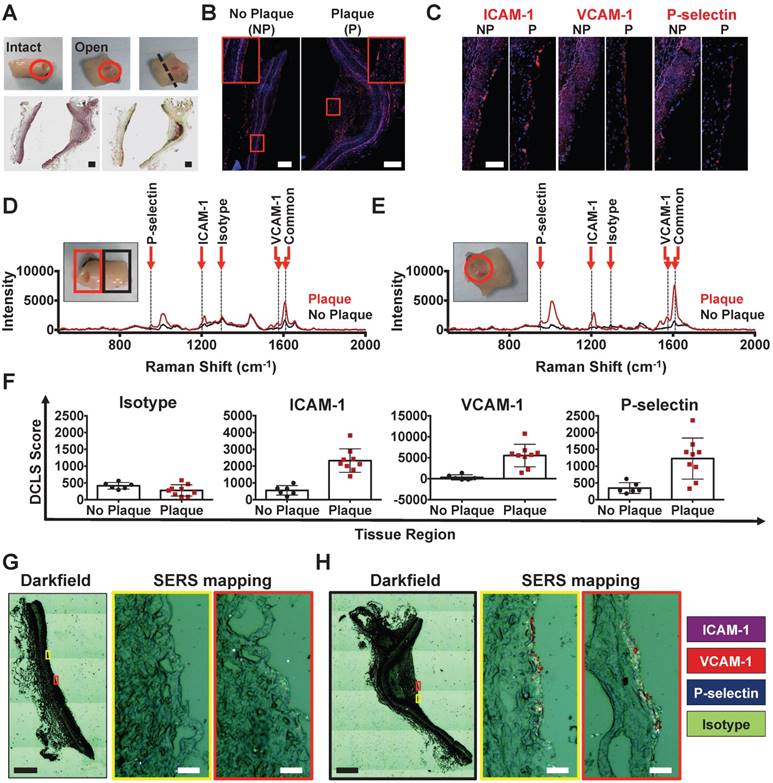 In vivo multiplex molecular imaging of vascular inflammation using ...