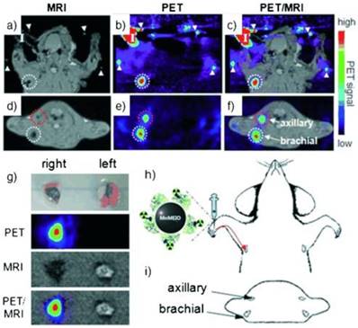 PET-MR and SPECT-MR multimodality probes: Development and challenges