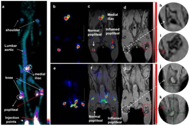 PET-MR and SPECT-MR multimodality probes: Development and challenges
