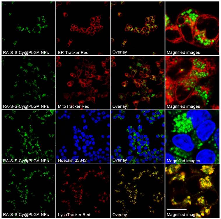 Redox Dual-Responsive and O2‑Evolving Theranostic Nanosystem for Highly ...