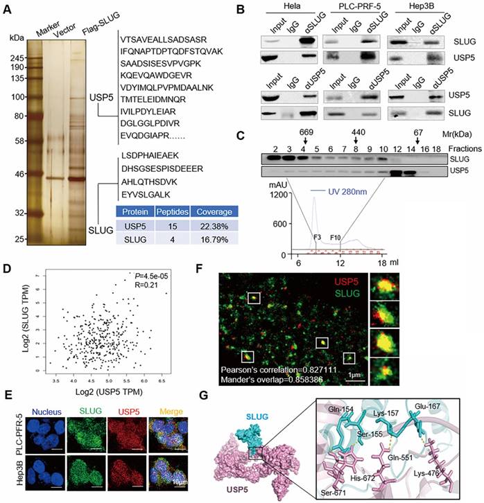USP5 promotes epithelial-mesenchymal transition by stabilizing SLUG in ...