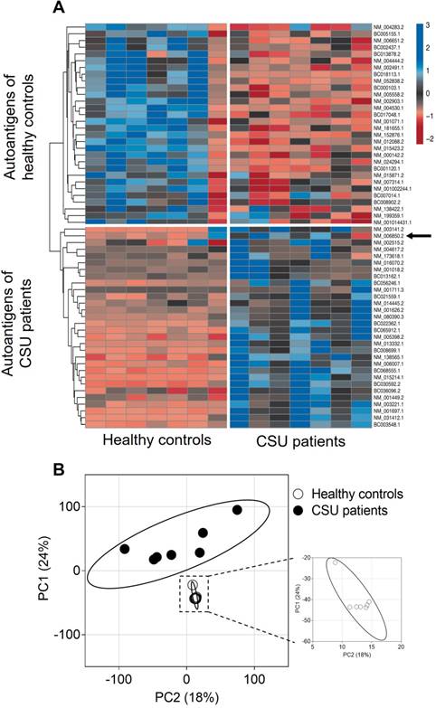 On the Lipophilic Nature of Autoreactive IgE in Chronic Spontaneous ...