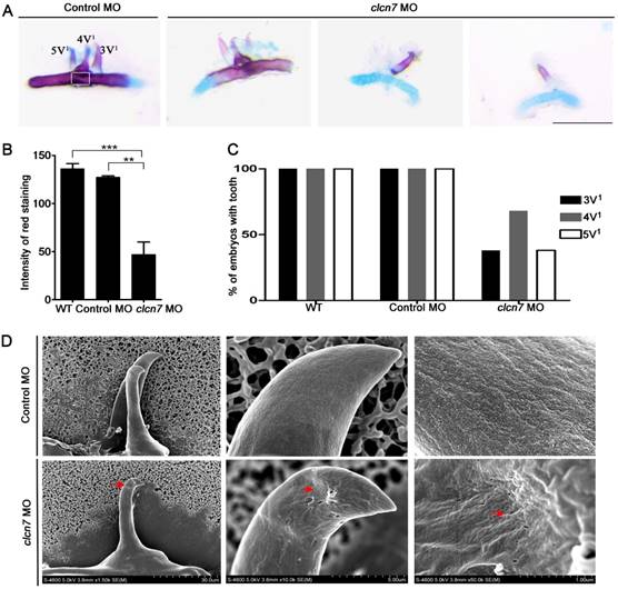 ClC-7 Regulates the Pattern and Early Development of Craniofacial Bone ...