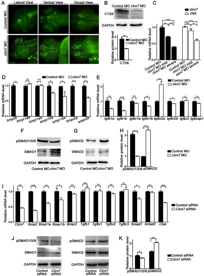 ClC-7 Regulates the Pattern and Early Development of Craniofacial Bone ...