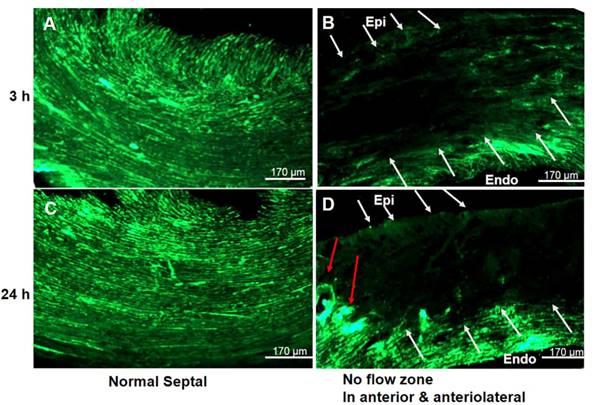 Molecular Imaging of Factor XIII Activity for the Early Detection of ...