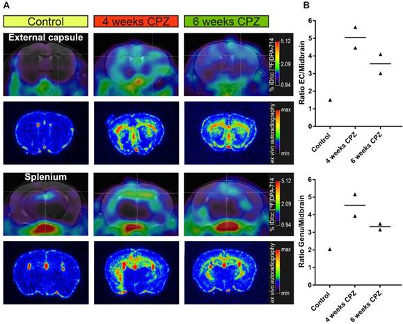 Molecular Imaging of Immune Cell Dynamics During De- and Remyelination ...