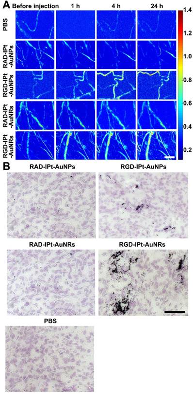 Tumor Chemo-Radiotherapy with Rod-Shaped and Spherical Gold Nano Probes ...