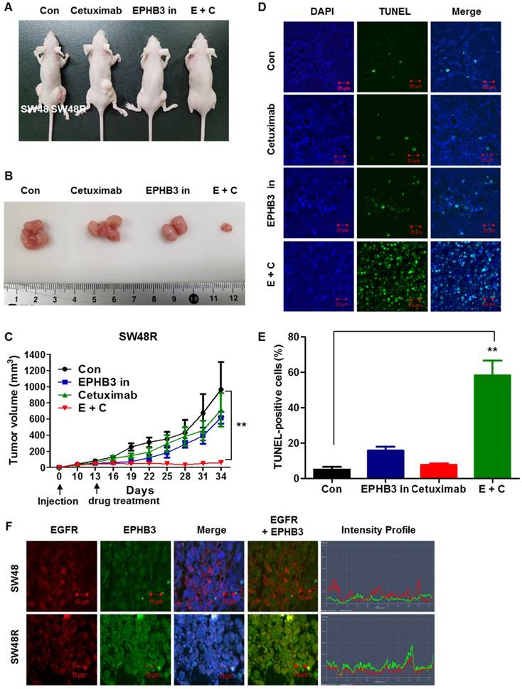 Sonic hedgehog pathway activation is associated with cetuximab ...
