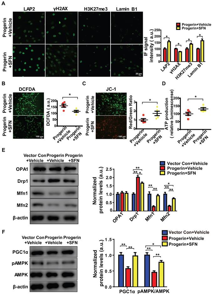 Progerin accumulation in nucleus pulposus cells impairs mitochondrial ...