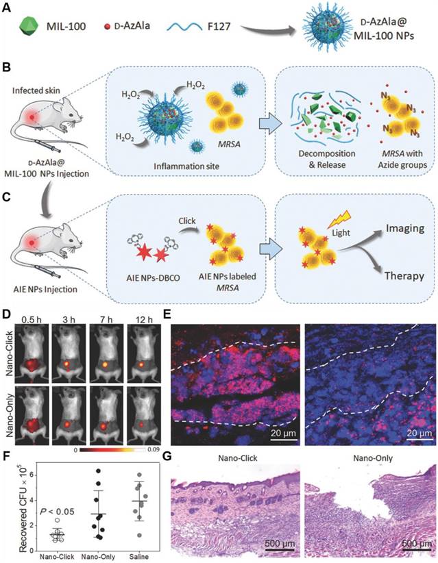 AIE-based theranostic systems for detection and killing of pathogens