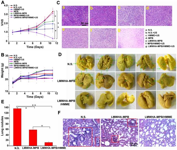 An in situ microenvironmental nano-regulator to inhibit the ...