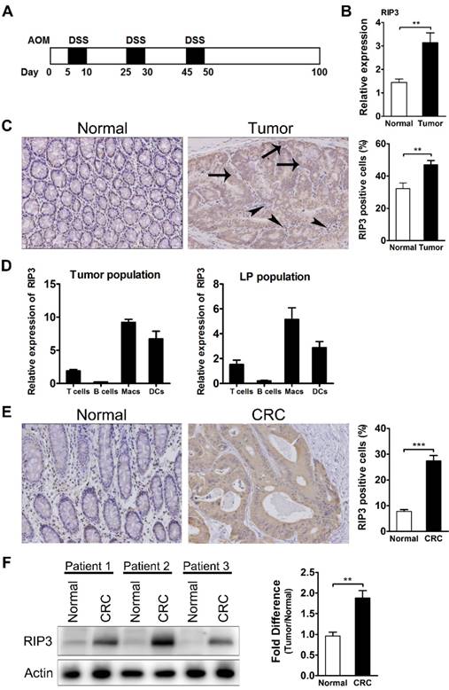 RIP3 promotes colitis-associated colorectal cancer by controlling tumor ...