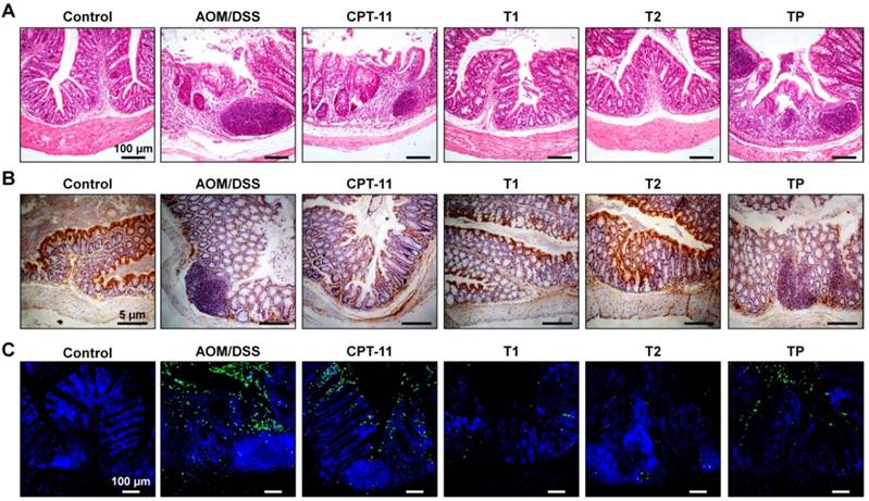A Multifunctional Nanotherapy for Targeted Treatment of Colon Cancer by ...