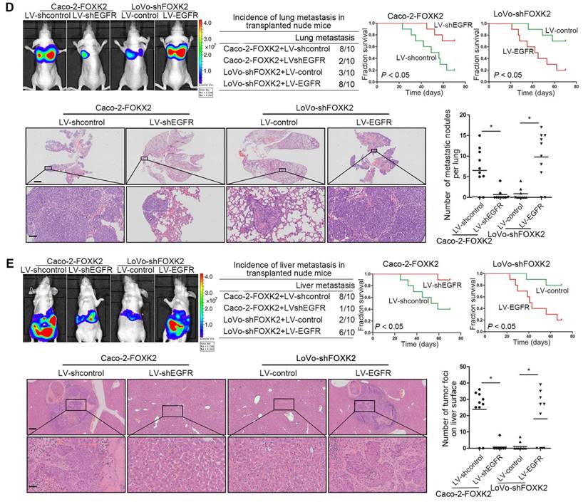 Forkhead box K2 promotes human colorectal cancer metastasis by ...