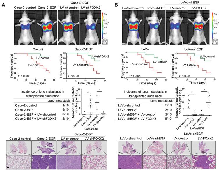 Forkhead box K2 promotes human colorectal cancer metastasis by ...