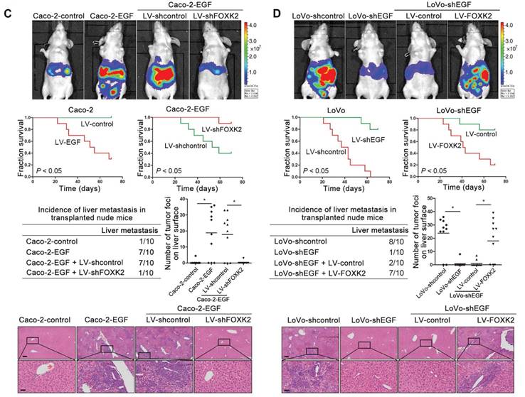 Forkhead box K2 promotes human colorectal cancer metastasis by ...