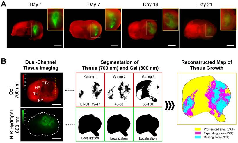 Dual-Channel Fluorescence Imaging of Hydrogel Degradation and Tissue ...