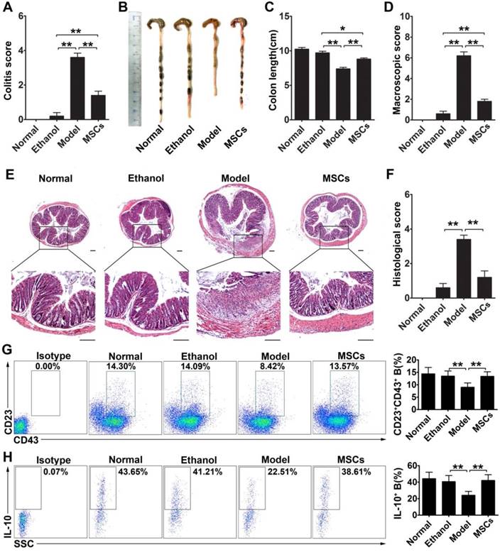 Human Mesenchymal Stem Cell-Treated Regulatory CD23+CD43+ B Cells ...