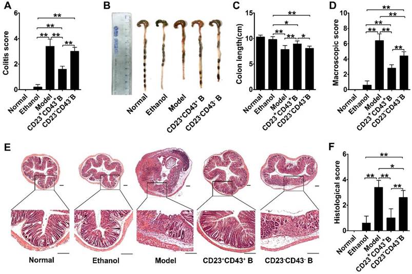 Human Mesenchymal Stem Cell-Treated Regulatory CD23+CD43+ B Cells ...