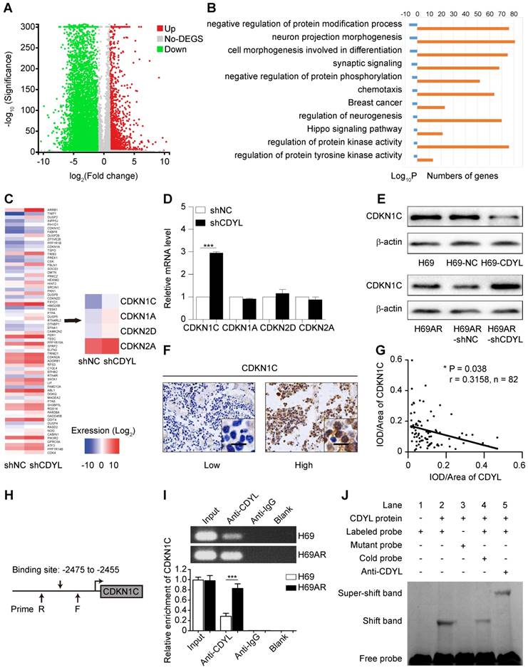 CDYL promotes the chemoresistance of small cell lung cancer by ...