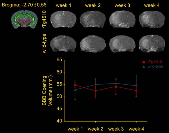 Unilateral Focused Ultrasound-Induced Blood-Brain Barrier Opening ...