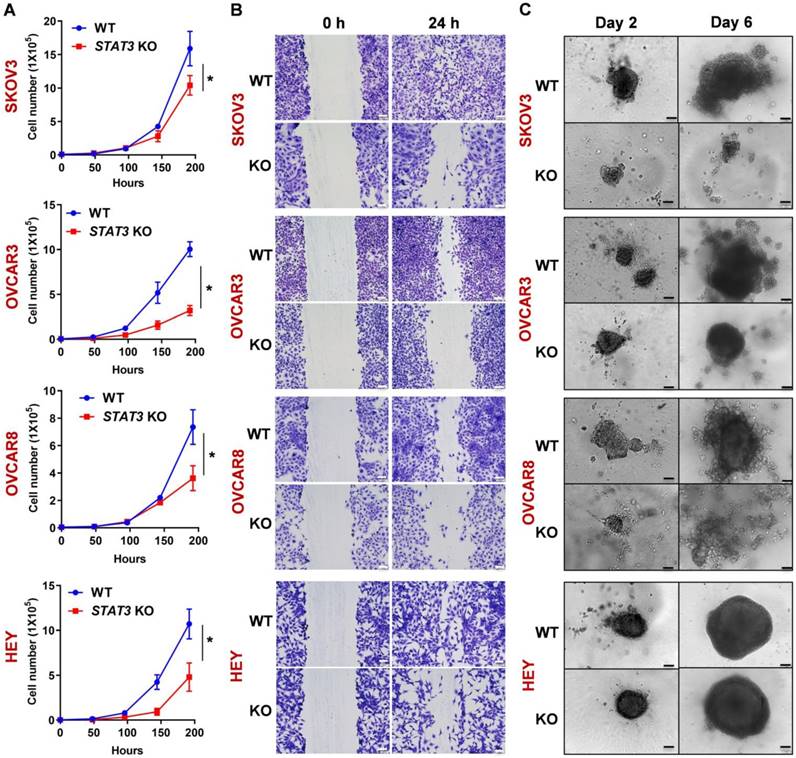 Multi-omics profiling reveals key signaling pathways in ovarian cancer ...