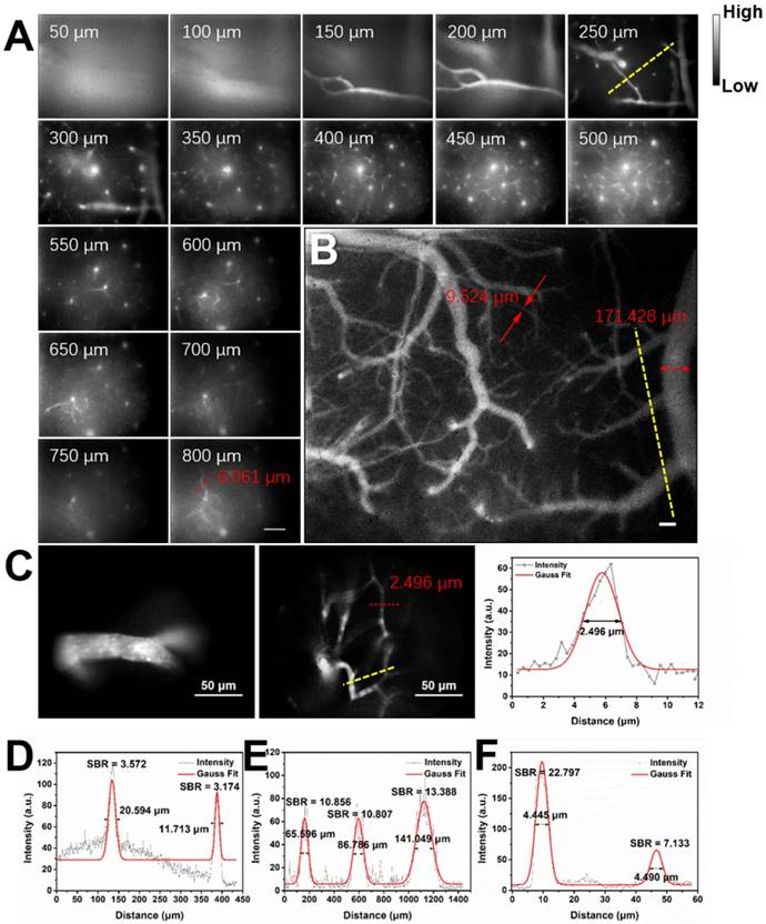 Excretable IR-820 for in vivo NIR-II fluorescence cerebrovascular ...
