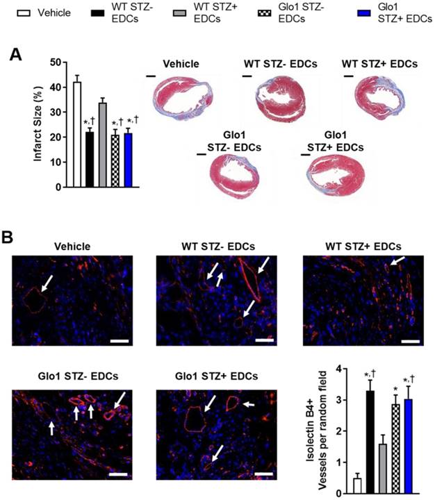 Glyoxalase 1 Prevents Chronic Hyperglycemia Induced Heart-Explant ...