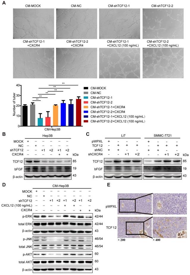 TCF12 promotes the tumorigenesis and metastasis of hepatocellular ...