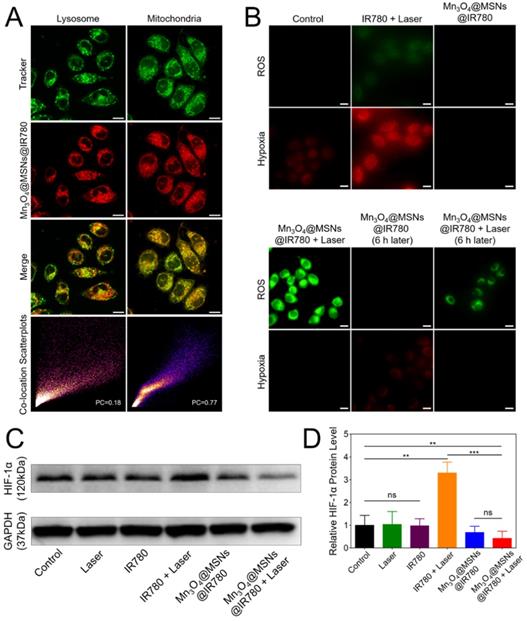 Self-generating oxygen enhanced mitochondrion-targeted photodynamic ...