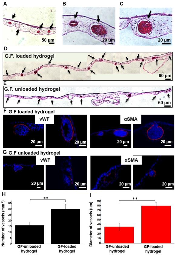 Bioinspired Self-assembling Peptide Hydrogel with Proteoglycan-assisted ...
