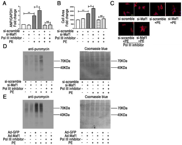Maf1 ameliorates cardiac hypertrophy by inhibiting RNA polymerase III ...