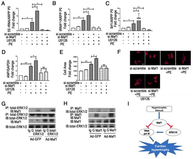 Maf1 ameliorates cardiac hypertrophy by inhibiting RNA polymerase III ...