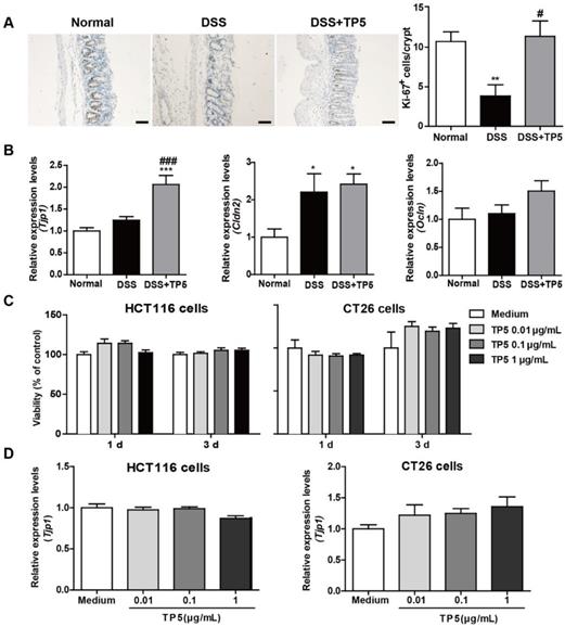 Thymopentin ameliorates dextran sulfate sodium-induced colitis by ...