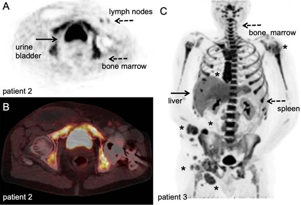 Imaging of T-cells and their responses during anti-cancer immunotherapy