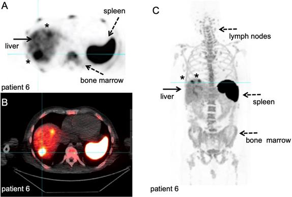 Imaging of T-cells and their responses during anti-cancer immunotherapy