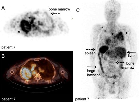 Imaging of T-cells and their responses during anti-cancer immunotherapy