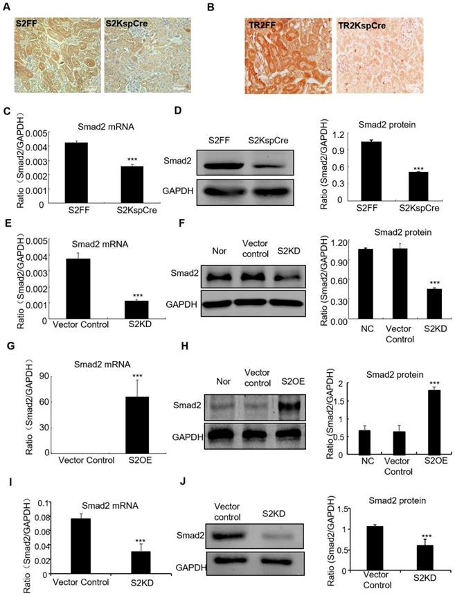 Conditional knockout of TGF-βRII /Smad2 signals protects against acute ...