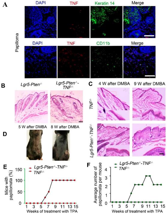 Pten loss in Lgr5+ hair follicle stem cells promotes SCC development