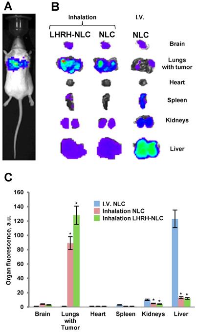 Strategy to enhance lung cancer treatment by five essential elements ...