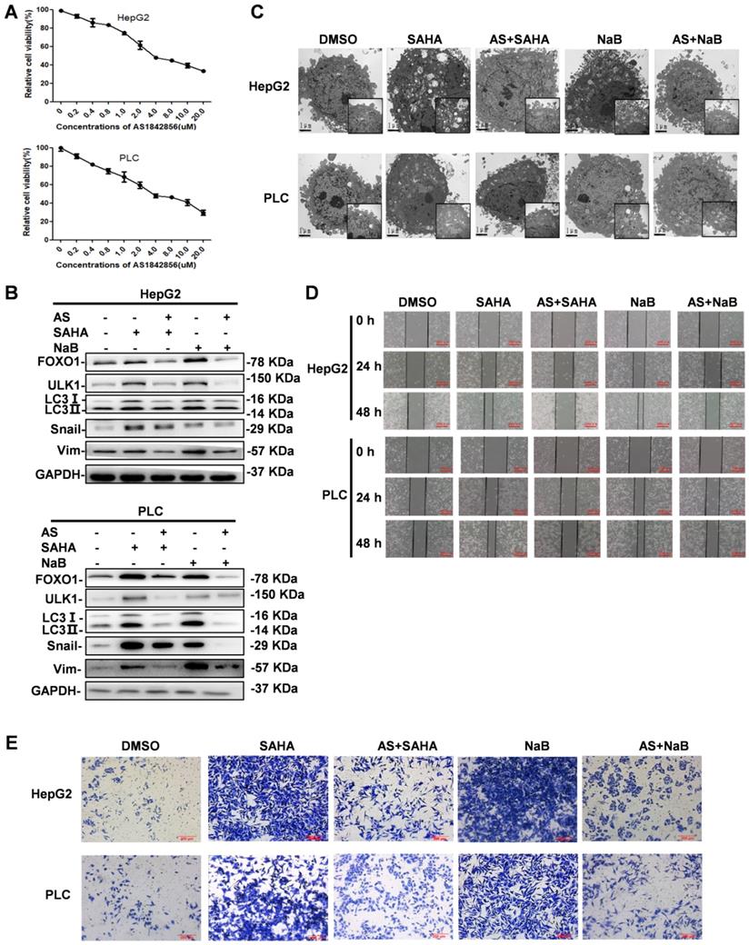Histone deacetylase inhibitors promote epithelial-mesenchymal ...