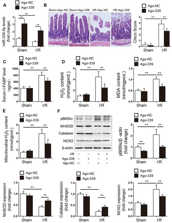 circ-PRKCB acts as a ceRNA to regulate p66Shc-mediated oxidative stress ...