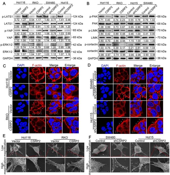 CSRP2 suppresses colorectal cancer progression via p130Cas/Rac1 axis ...