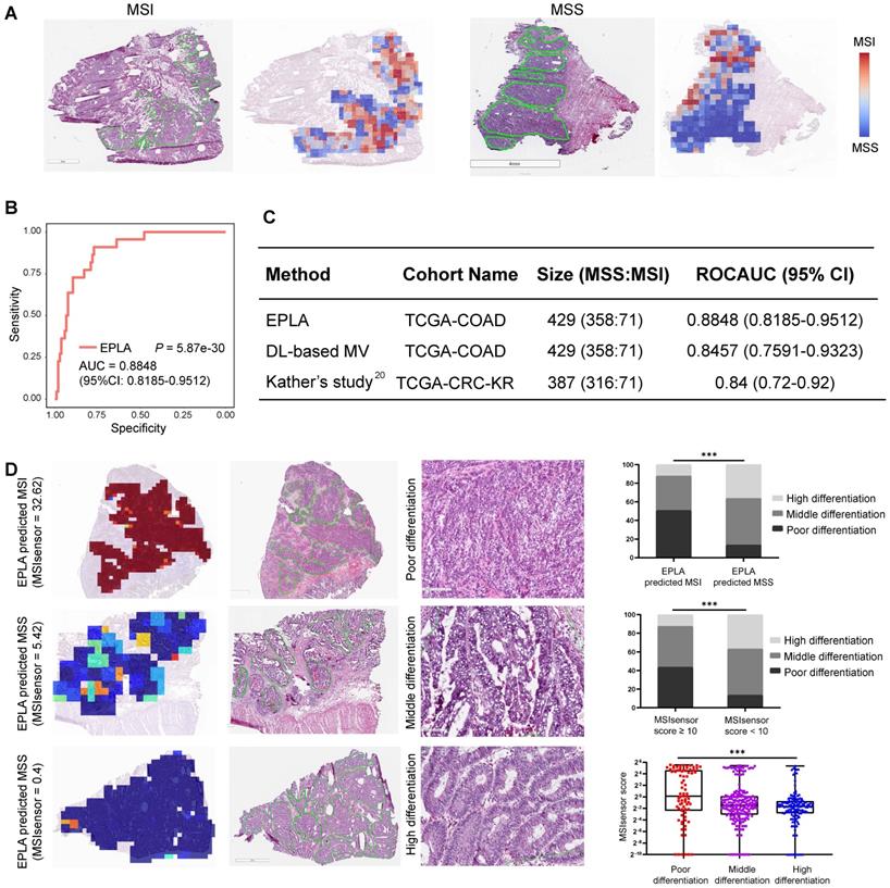 Development and interpretation of a pathomics-based model for the ...