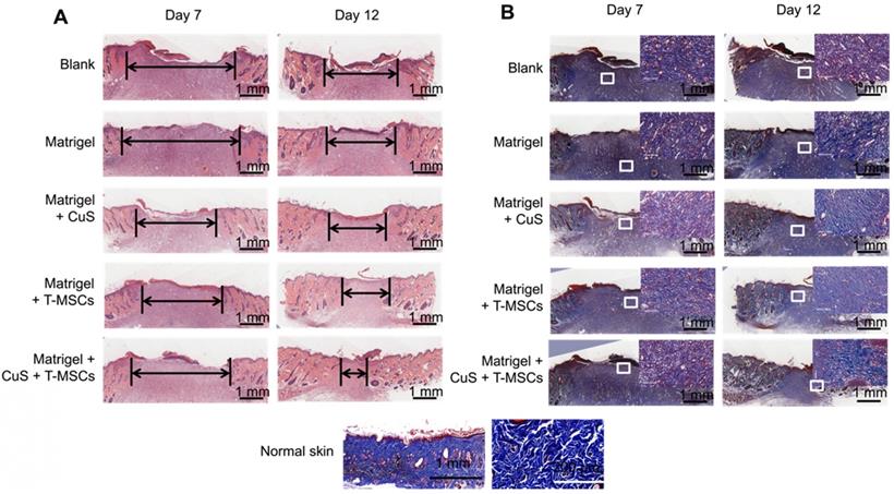 Ultrasmall CuS@BSA nanoparticles with mild photothermal conversion ...