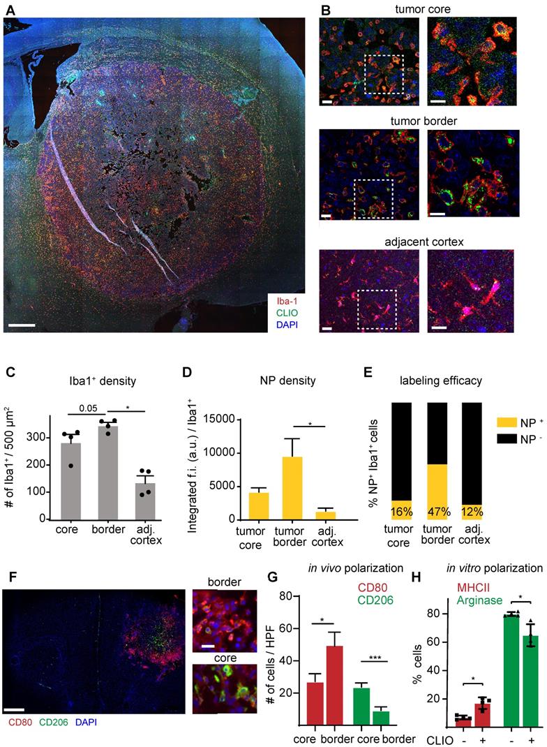 Monitoring innate immune cell dynamics in the glioma microenvironment ...