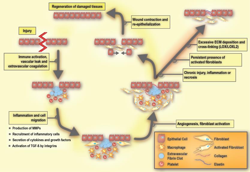 Towards extracellular matrix normalization for improved treatment of ...